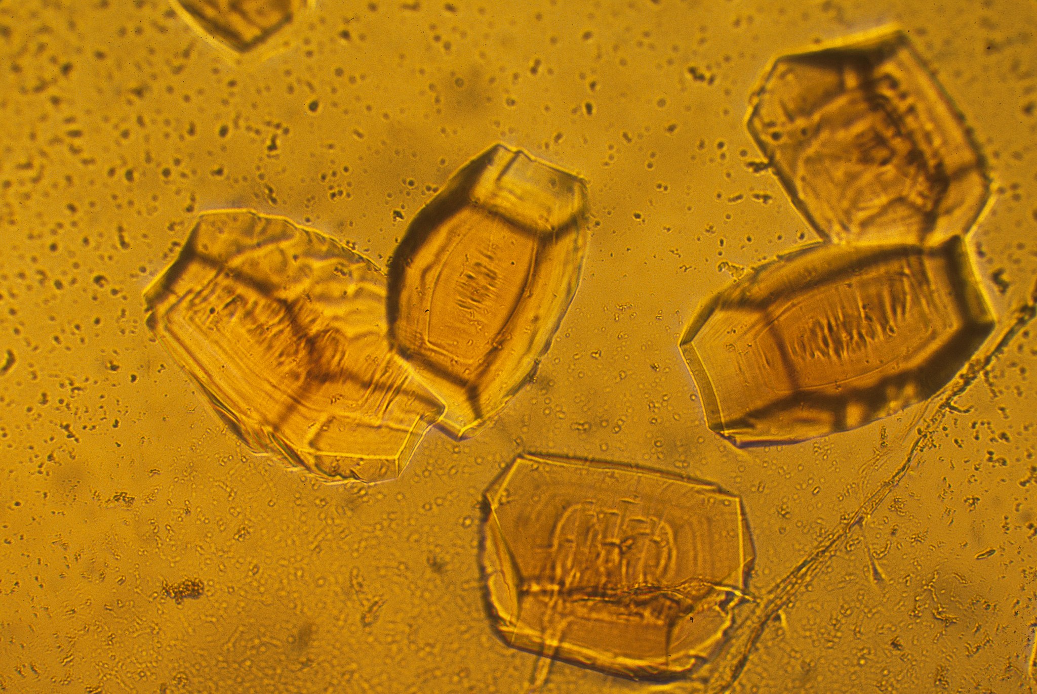 Structural studies of cell wall proteins involved during pathogenesis ...
